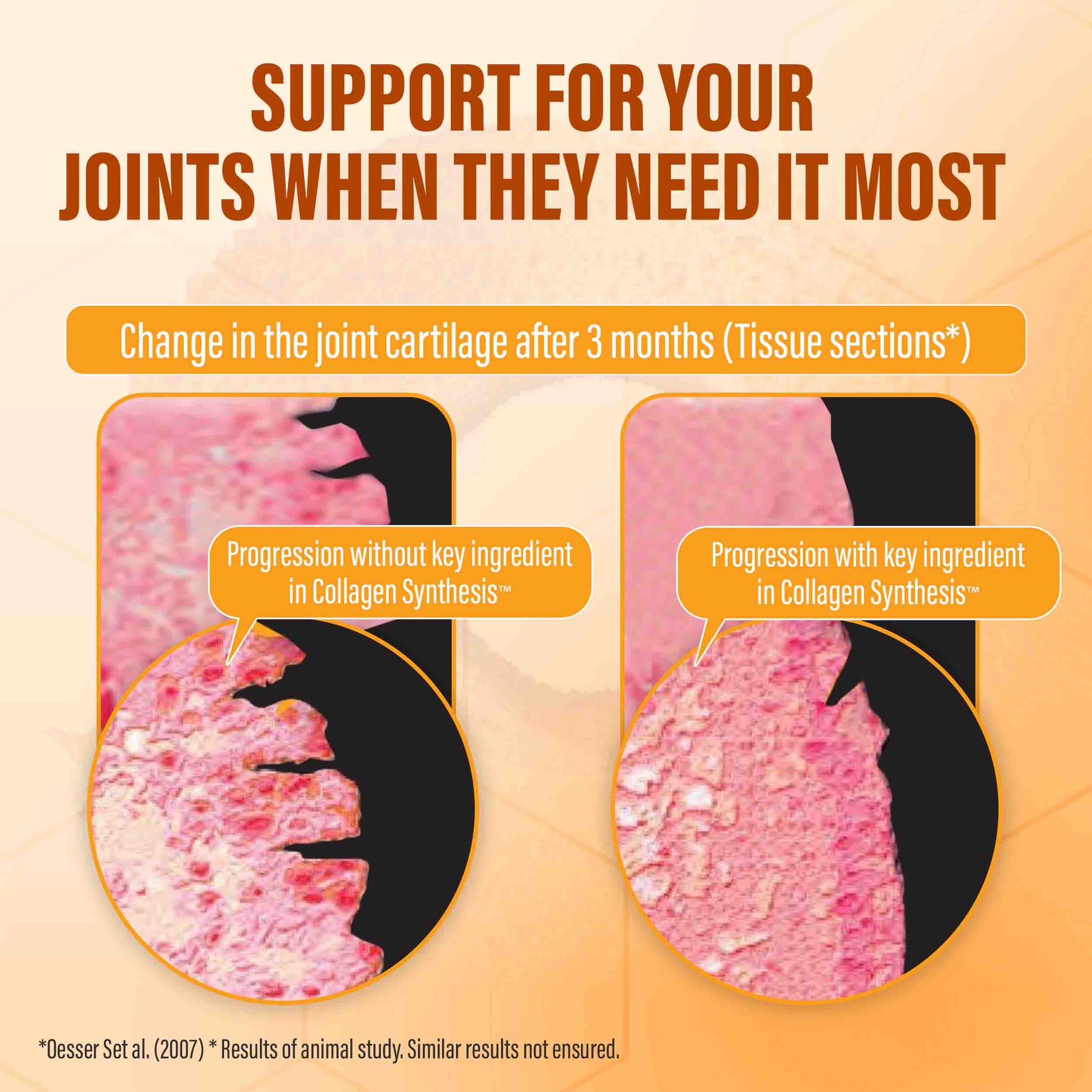 COLLAGEN SYNTHESIS - Collagen Peptides for Tendon, Ligament, & Cartila